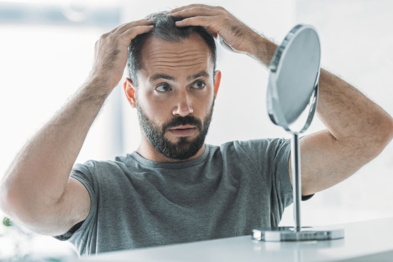 Les 7 stades de la calvitie chez l'homme