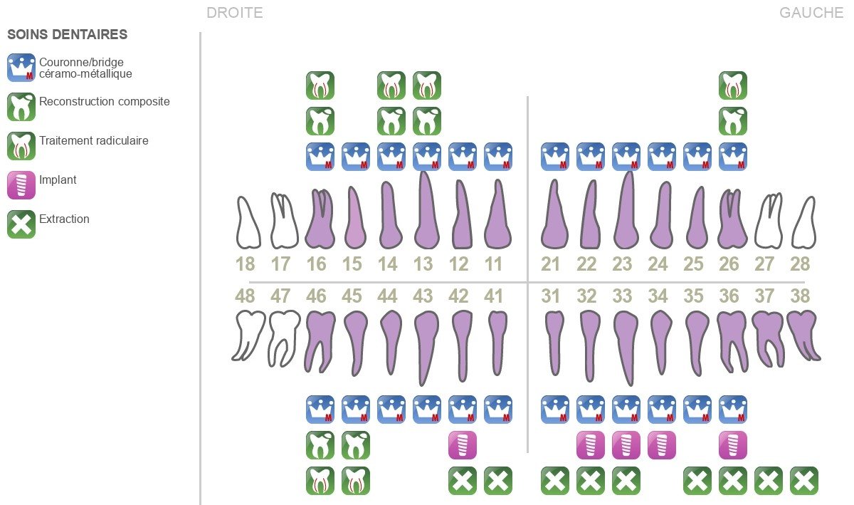 Comprendre et Lire un Devis Dentaire : Comment ça marche