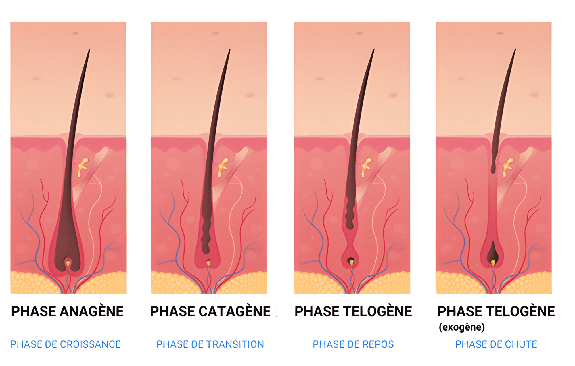 Qu'est ce qu'un greffon ? Comprendre la greffe de cheveux