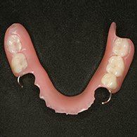 Prothèse dentaire provisoire : Solution de confort temporaire