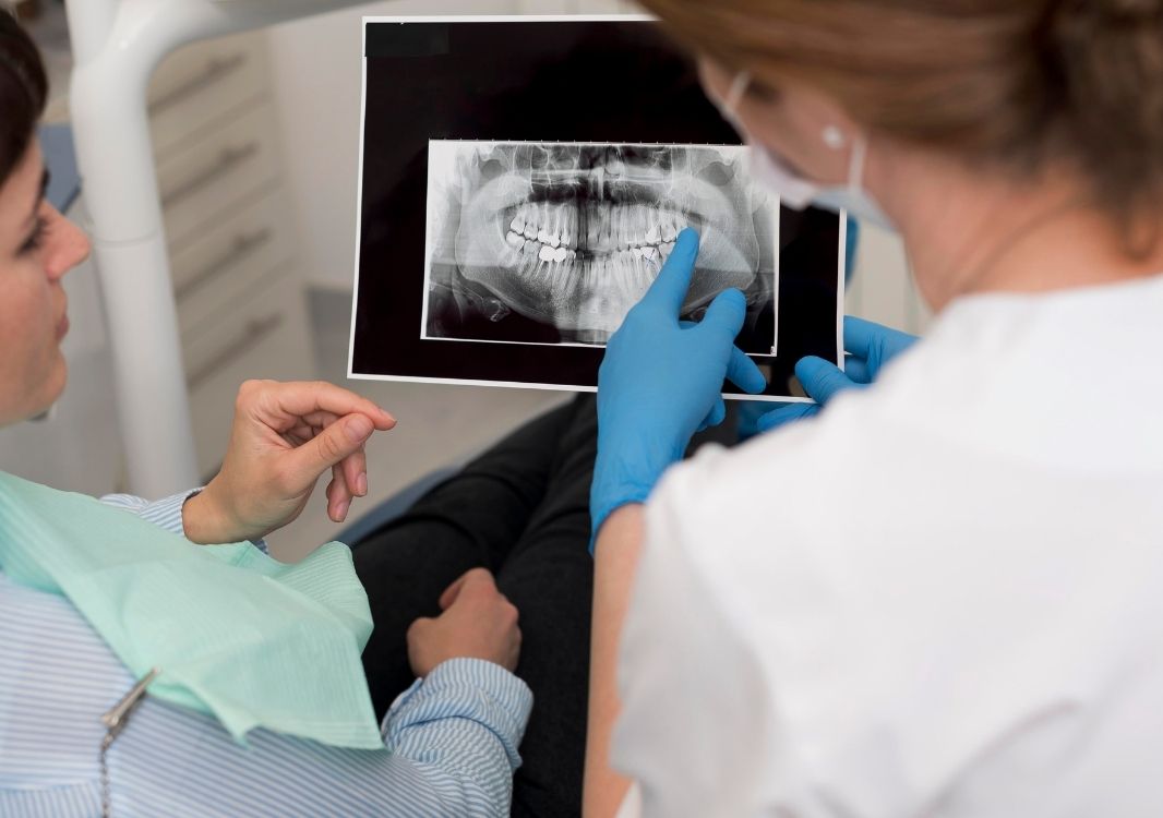 Implant dentaire ou dent sur pivot : Comment les différencier