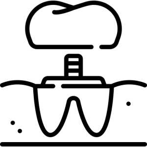 Implant dentaire ou dent sur pivot : Comment les différencier