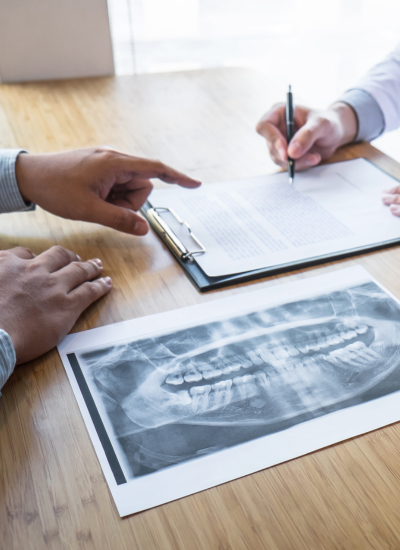 Pose d’une prothèse dentaire fixe : quelles sont les étapes