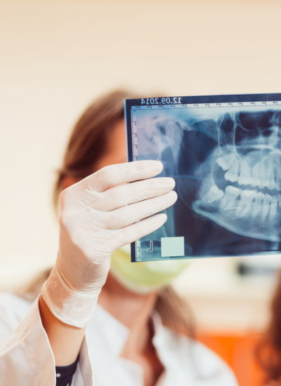 Pose d’une prothèse dentaire fixe : quelles sont les étapes